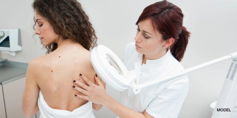 Melanocytic Nevi - Recurrent Nevus | Perri Dermatology